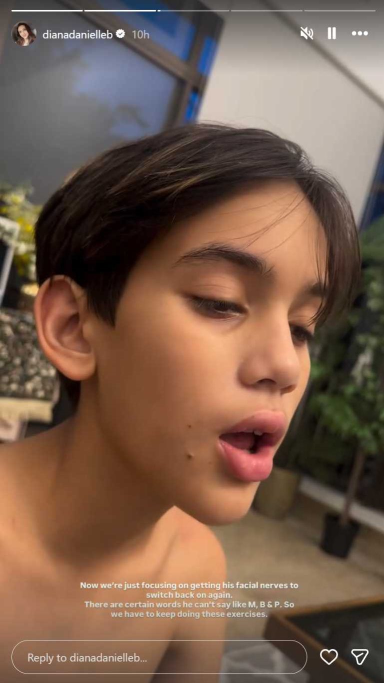 Anak Diana Danielle Alami Lumpuh Muka Tiba-Tiba, Doktor Syak GBS Atau ...